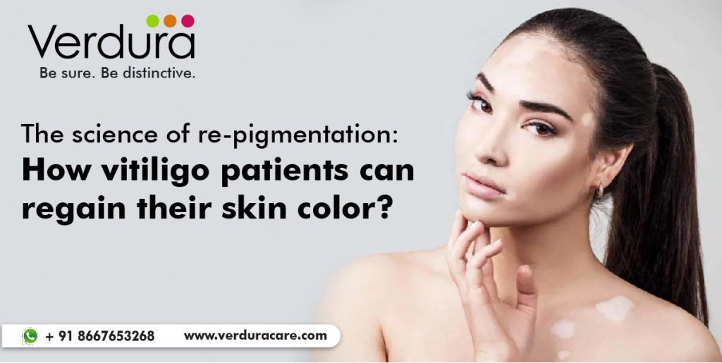 The Science of Re-pigmentation: How Vitiligo Patients Can Regain Their ... The Science of Re-pigmentation: How Vitiligo Patients Can Regain Their ...